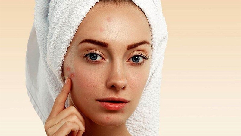 Hiểu đúng thủ phạm gây mụn để tránh chúng thông qua vị trí mọc của mụn ...